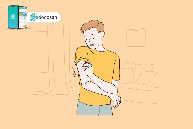 Bệnh mề đay: Nguyên nhân, triệu chứng, cách điều trị | Doctor có sẵn