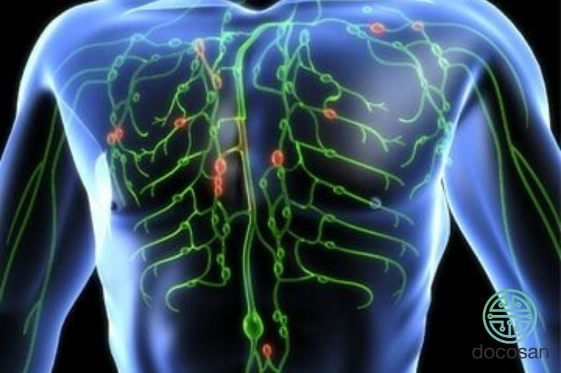 Bệnh u lympho: Nguyên nhân, triệu chứng và điều trị | Doctor có sẵn