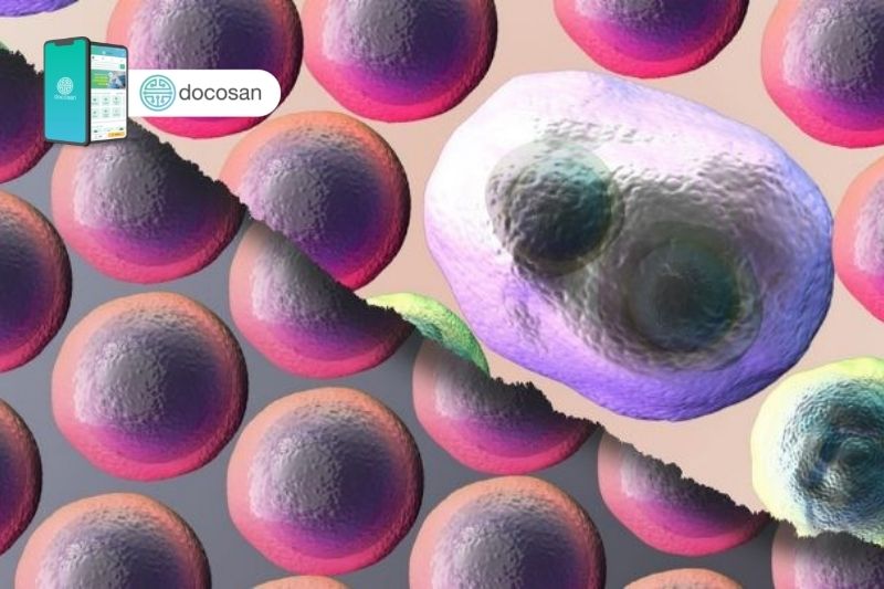 U lympho không Hodgkin và u lympho Hodgkin làm sao phân biệt? | Doctor ...