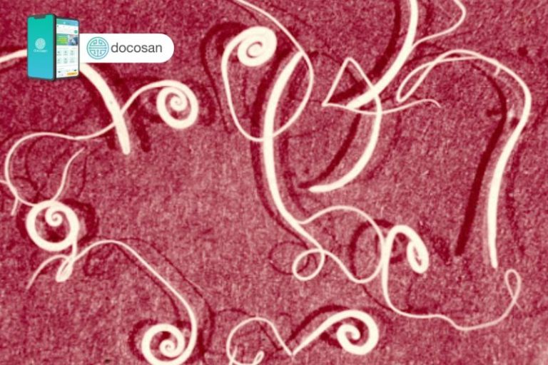 Giun tóc: Nguyên nhân, dấu hiệu, điều trị, phòng ngừa - Docosan