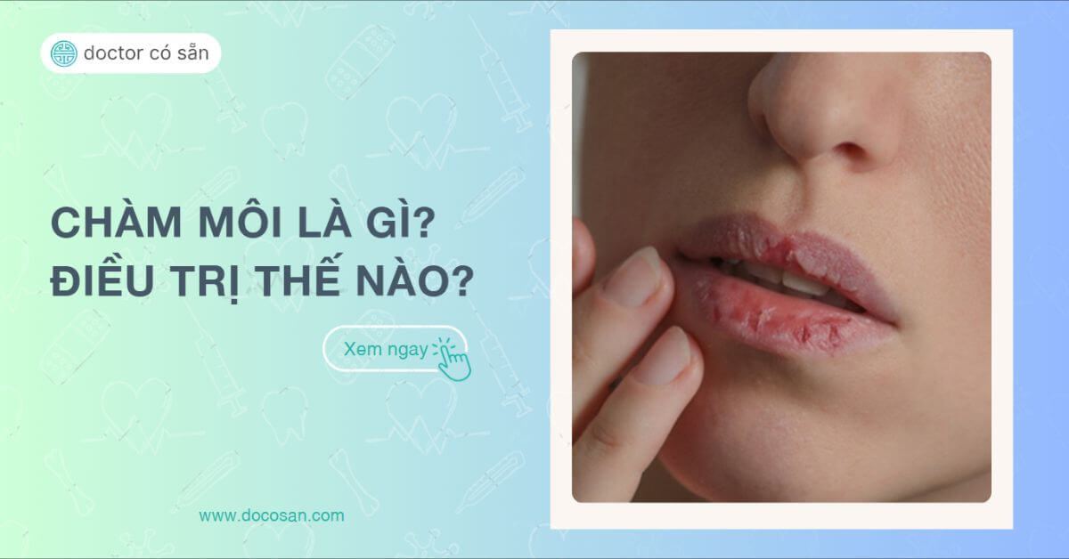 Chàm môi là gì? Nguyên nhân, triệu chứng, điều trị hiệu quả