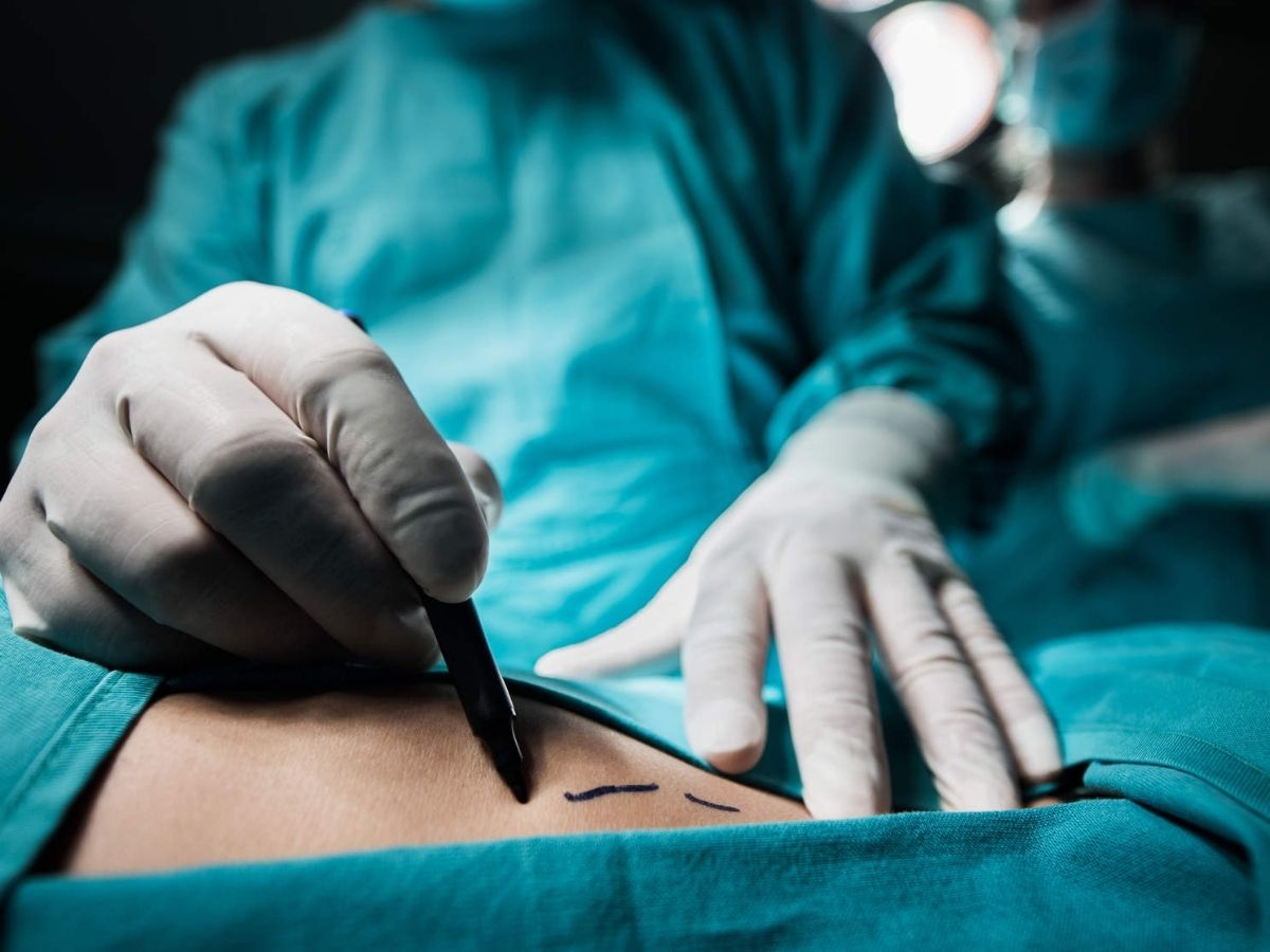 Những phương pháp điều trị sỏi túi mật hiệu quả hiện nay | Doctor có sẵn