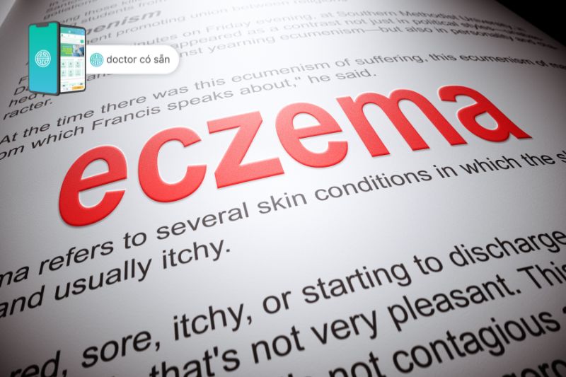 Eczema: Causes, symptoms and treatments | Doctor có sẵn