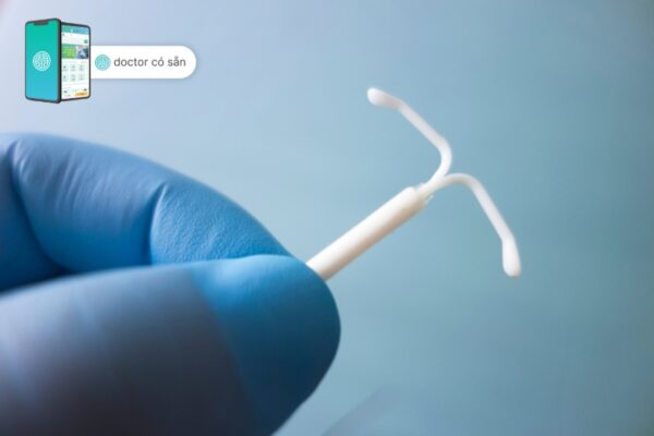 Copper IUD: Your comprehensive guide | Doctor có sẵn