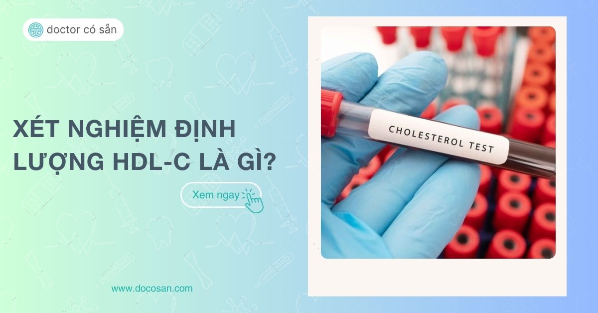 Xét nghiệm định lượng HDL-C là gì? Đối tượng và quy trình