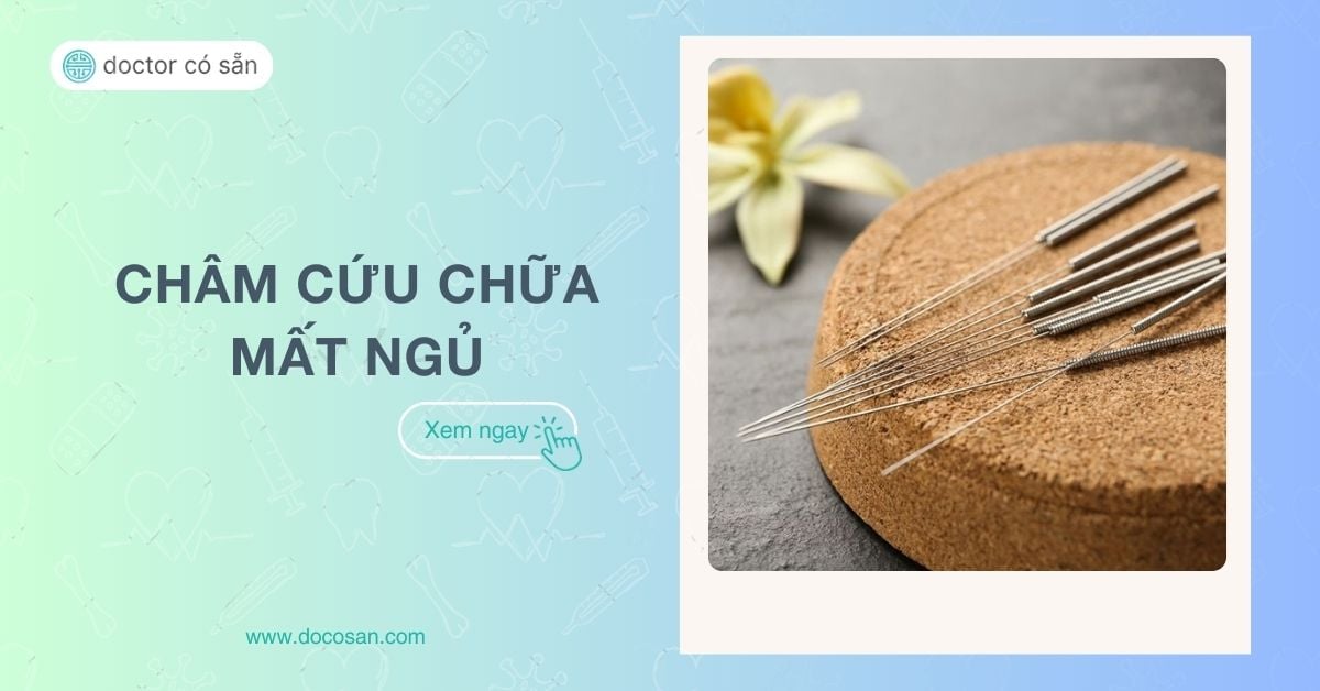Châm cứu chữa mất ngủ: bí quyết tự nhiên, an toàn, hiệu quả cao