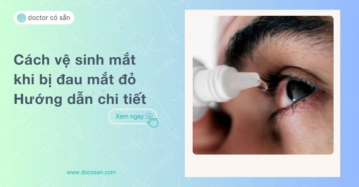 Cách vệ sinh mắt khi bị đau mắt đỏ: Hướng dẫn chi tiết