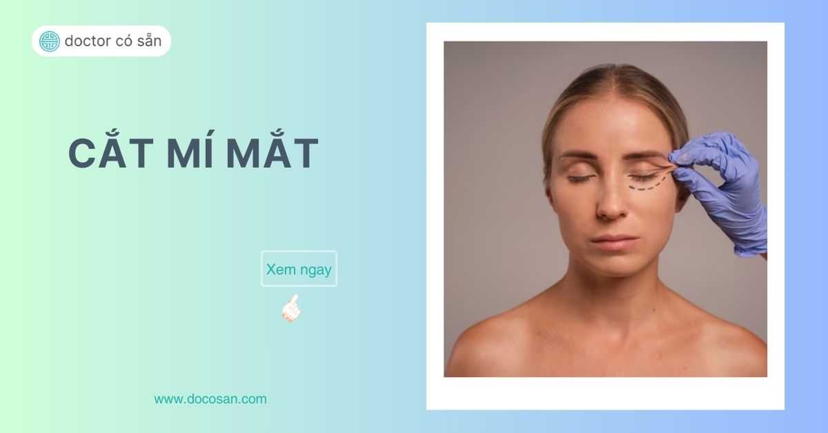 Cắt mí mắt có được vĩnh viễn không? Bí quyết giữ mí mắt đẹp | Doctor có sẵn