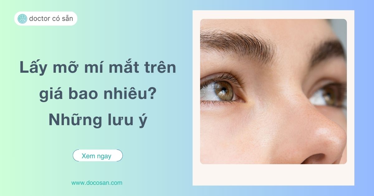 Lấy mỡ mí mắt trên bao nhiêu tiền? Lưu ý khi lấy mỡ mí mắt trên